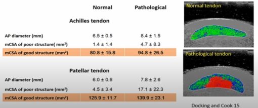 7 absolutely crucial facts you didn’t know about tendons – Fitnessology