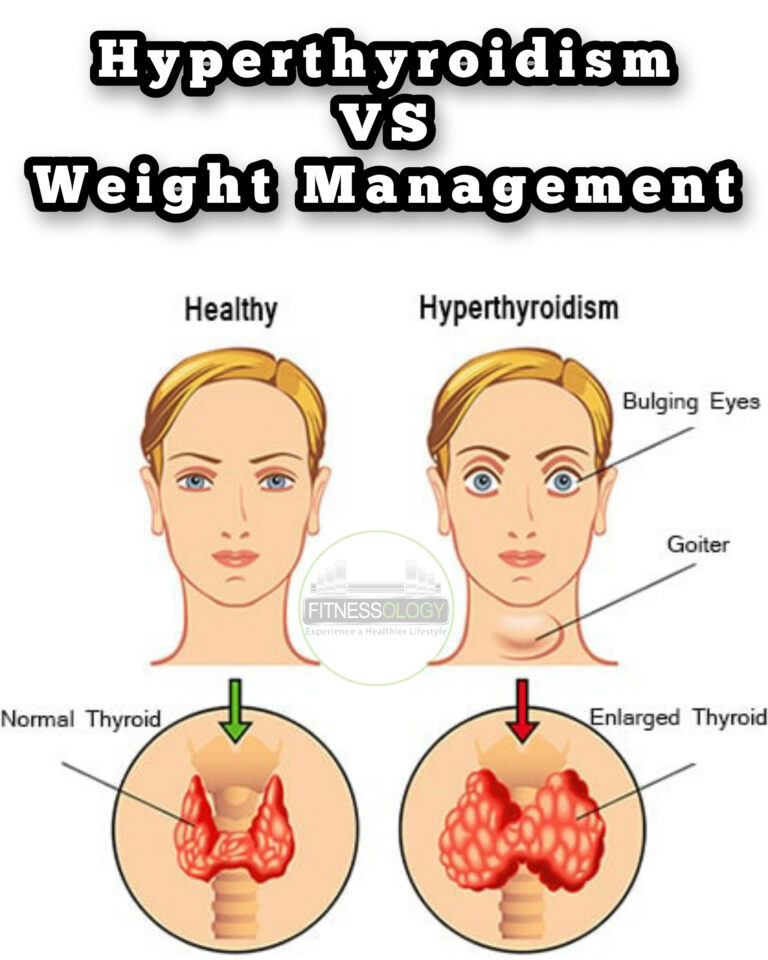 Can Hyperthyroidism Cause Weight Gain? – Fitnessology